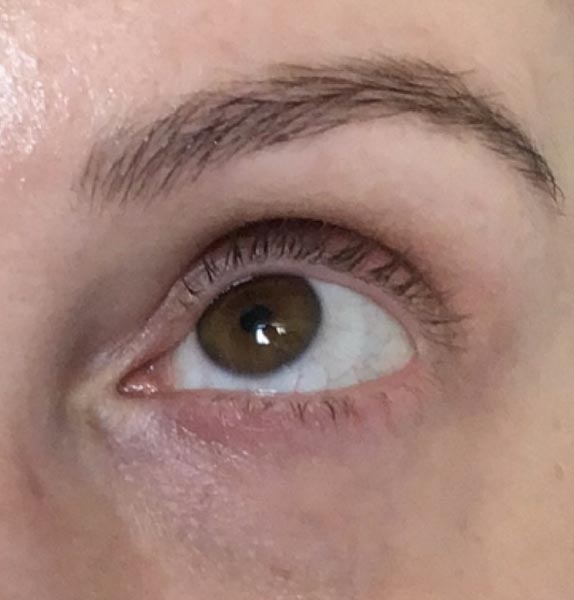 Polynucleotides | Anna Baker Aesthetics | East Grinstead